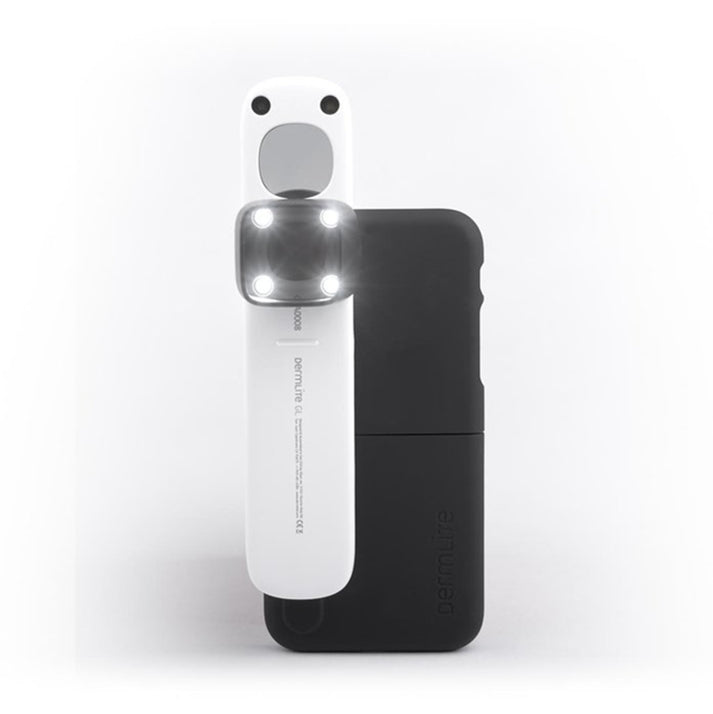 DermLite GL Dermatoscope, Polarized Light, Smartphone-Compatible, USB ...